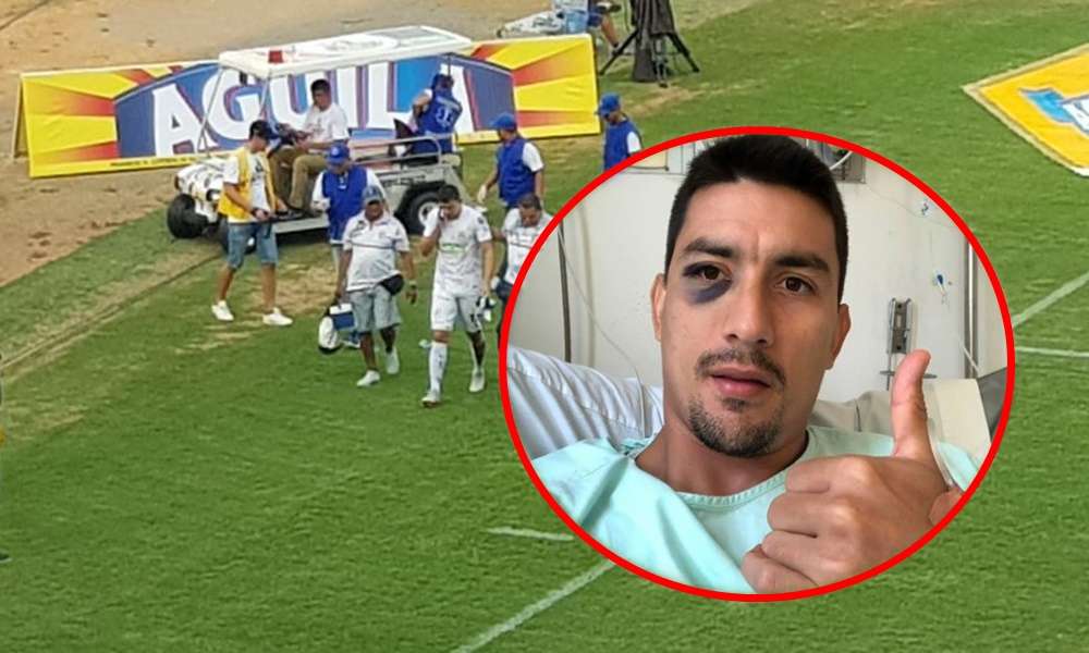 Portero de Jaguares estará dos meses por fuera de las canchas tras ... Portero de Jaguares estará dos meses por fuera de las canchas tras ...